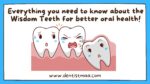 Everything you need to know about the Wisdom Teeth for better oral ...