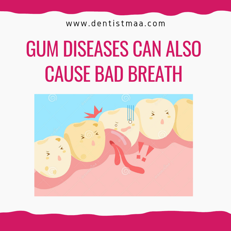 10 Causes and their Remedies for Bad Breath (Halitosis) in Children ...