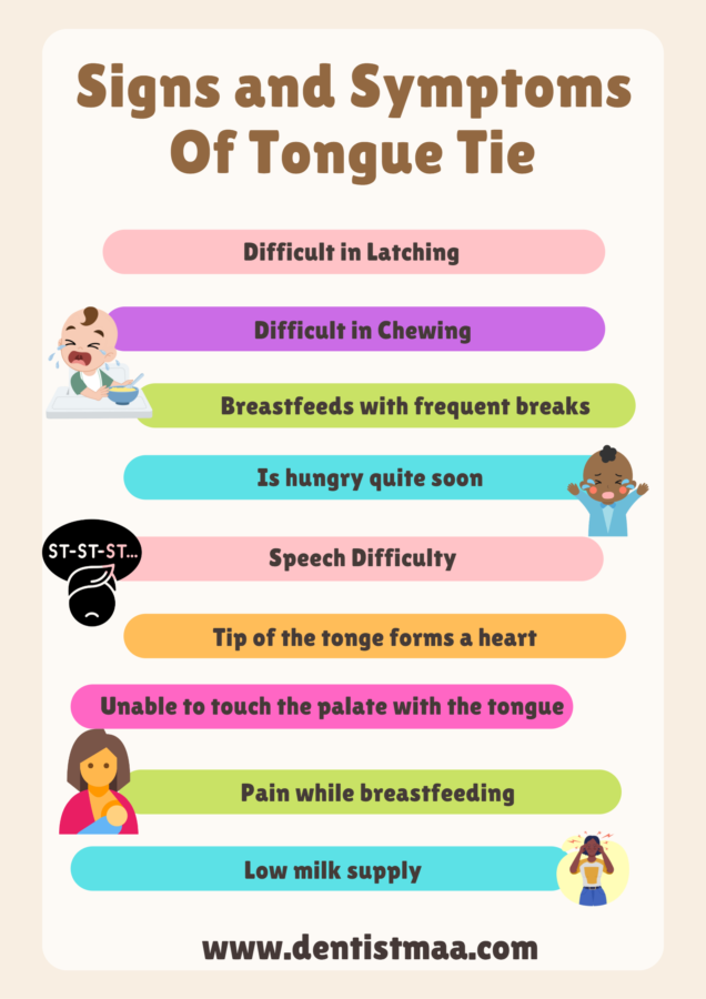 Tongue Tie (Ankyloglossia): All You Need To Know - DentistMaa